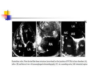 Chiari Network Definition