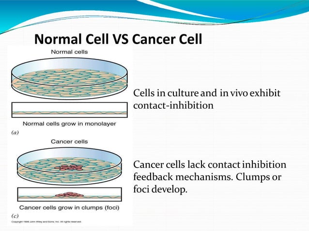 Normal vs cancer -Pooja Murkar | PPT