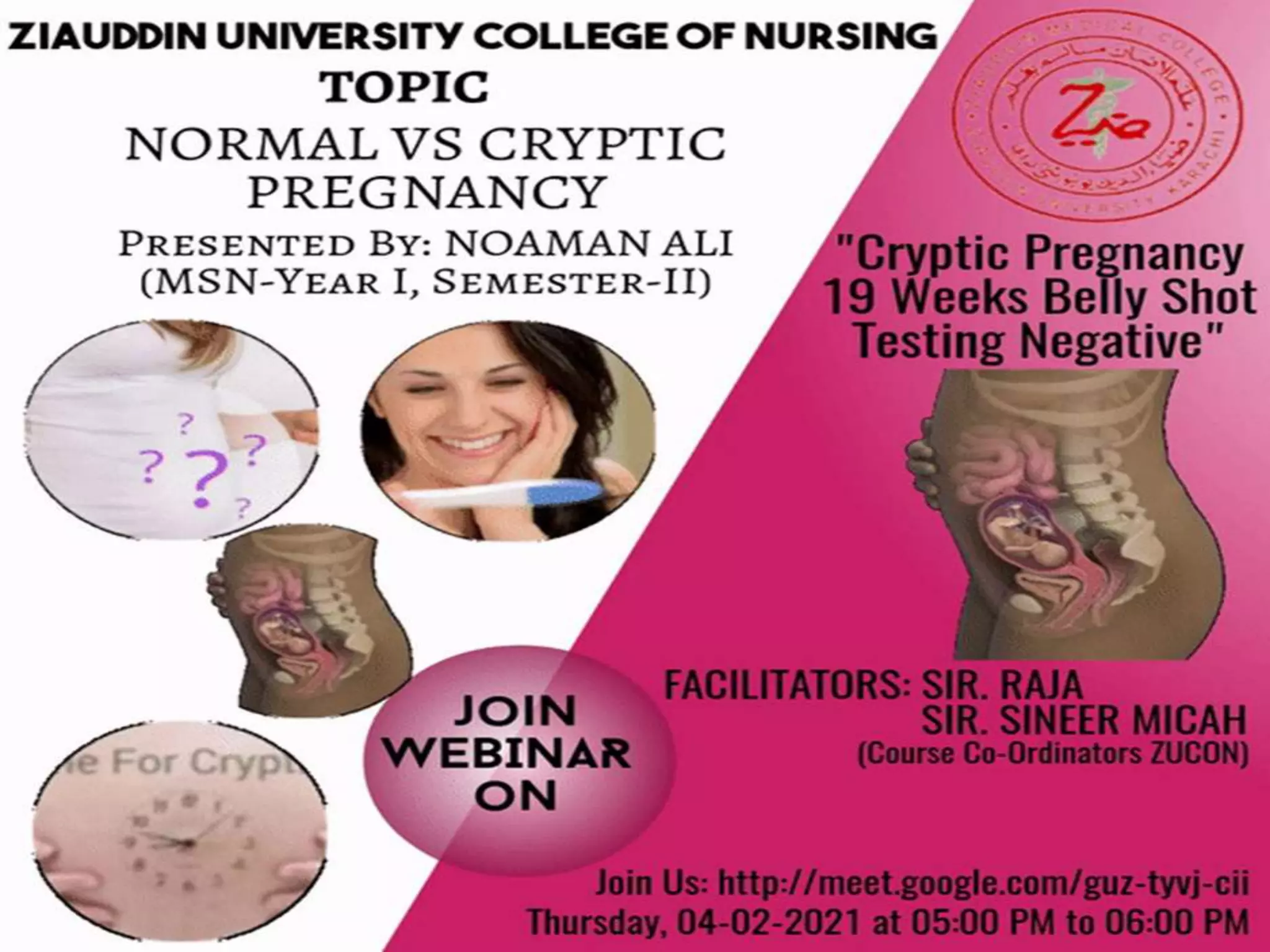 Normal vs cryptic pregnancy Noaman Ali study | PPTX