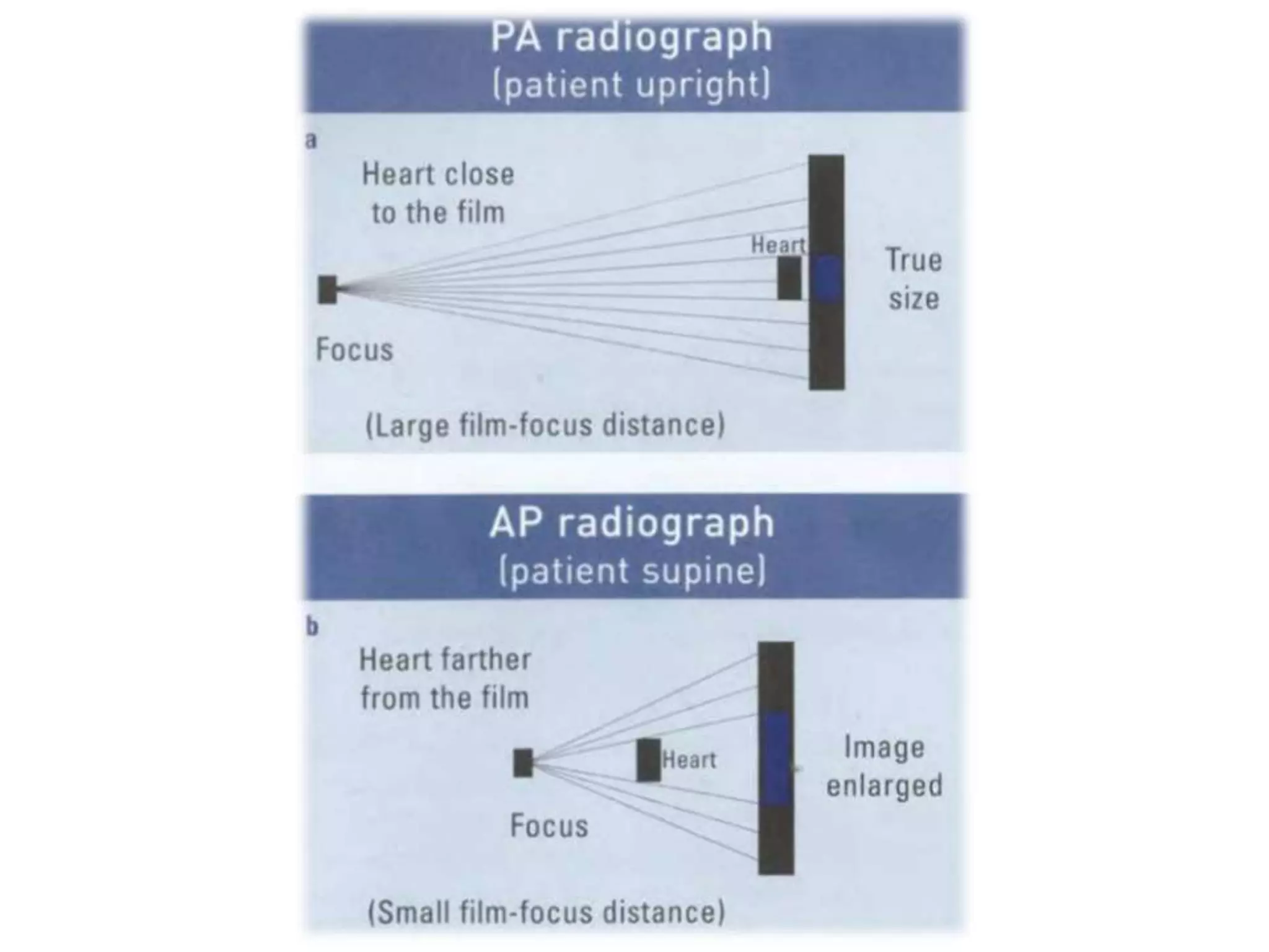Normal chest x ray | PPT