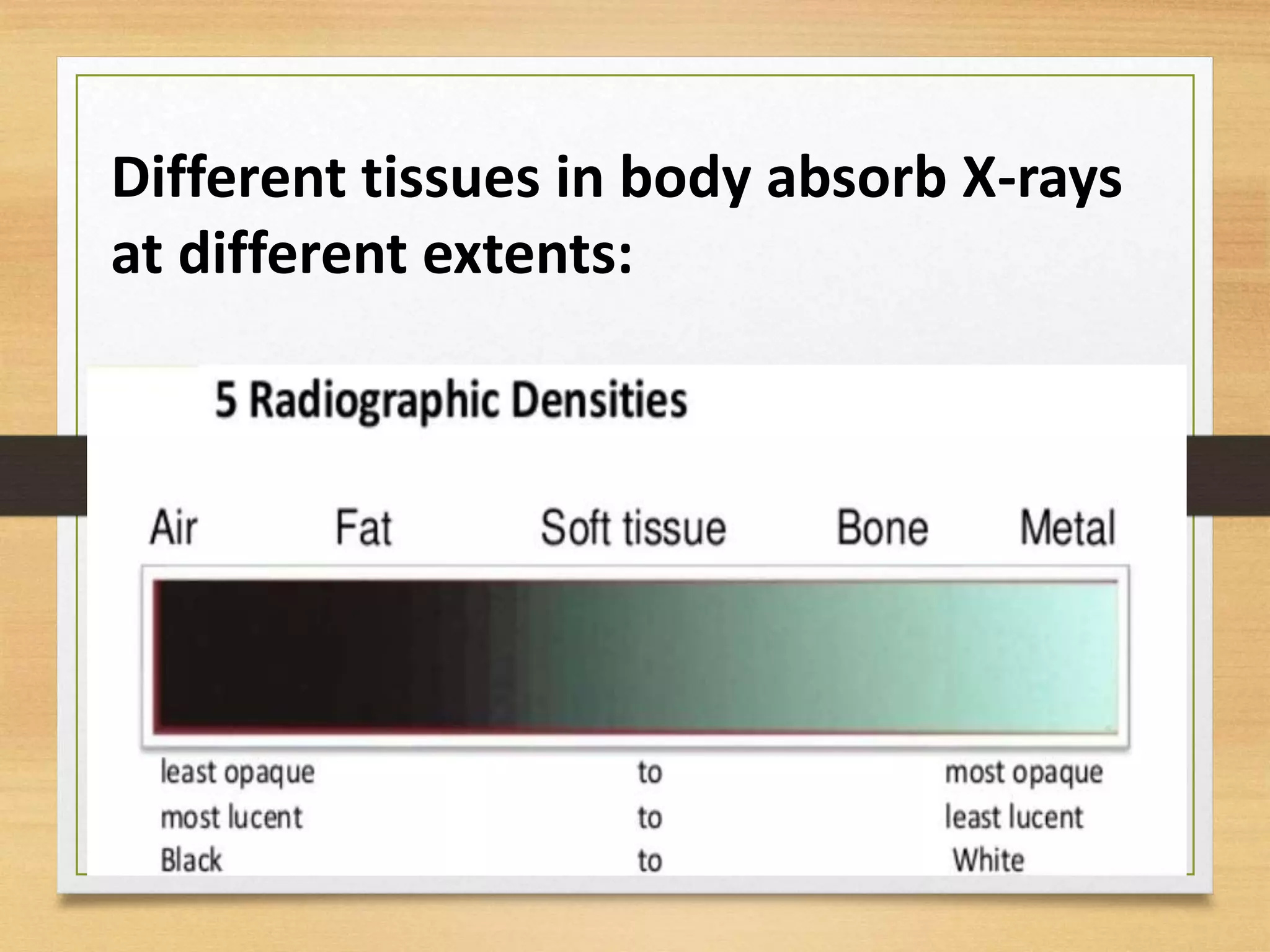 Normal chest x ray | PPTX