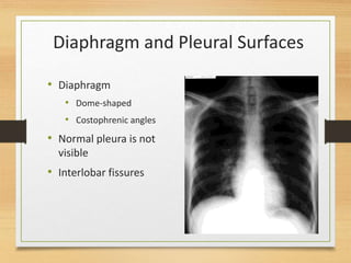 Normal chest x ray | PPTX
