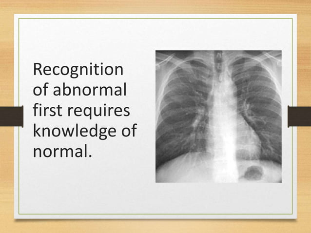Normal chest x ray | PPT