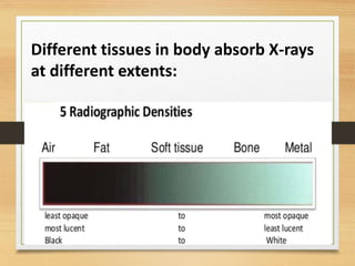 Normal chest x ray | PPT