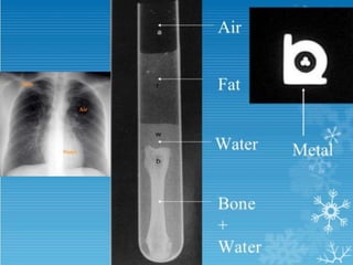 Normal chest x ray | PPT