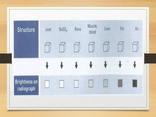 Normal chest x ray | PPT