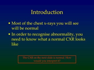 normalxray.PPT