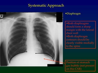 normalxray.ppt