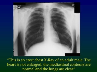 normalxray.ppt
