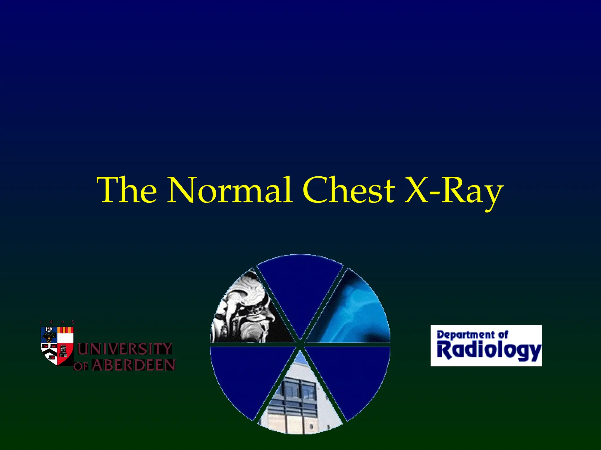 normal Chest x-ray radiological landmarks.ppt