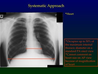 normal Chest x-ray radiological landmarks.ppt