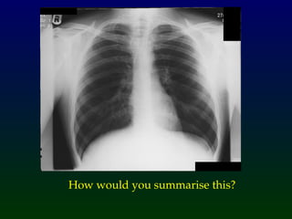 normal chest radiohgraphy interpretation .ppt