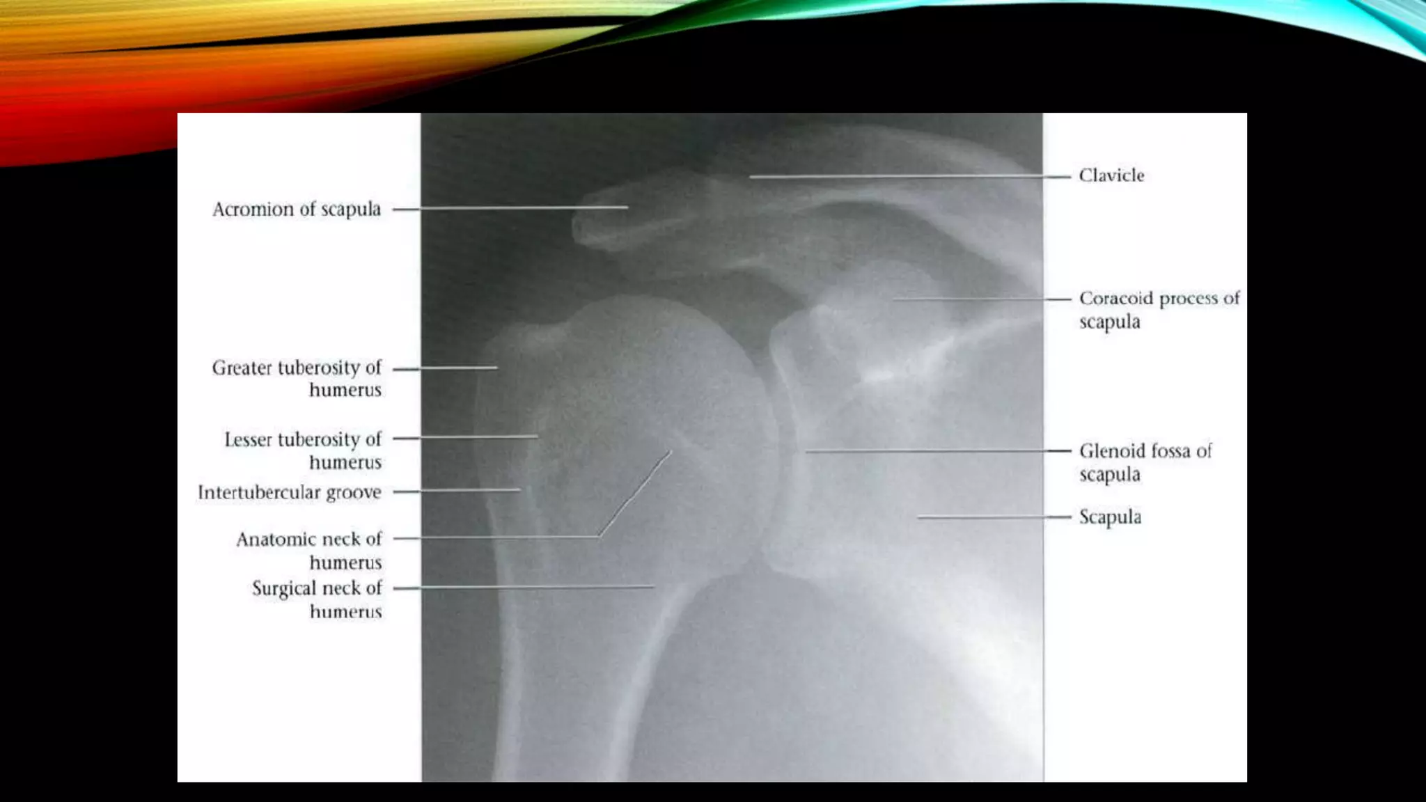 Normal X ray of long bones.pptx