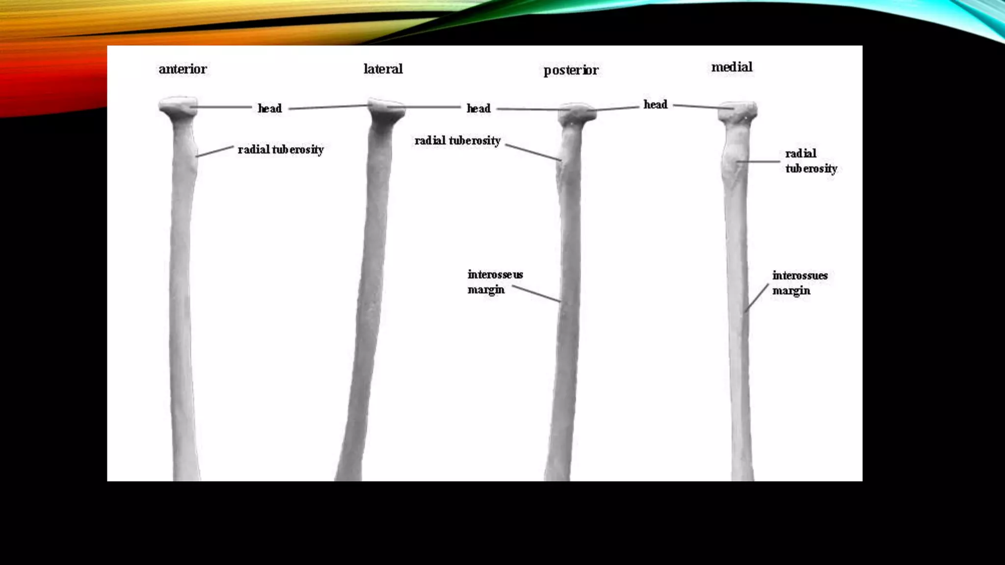 Normal X ray of long bones.pptx