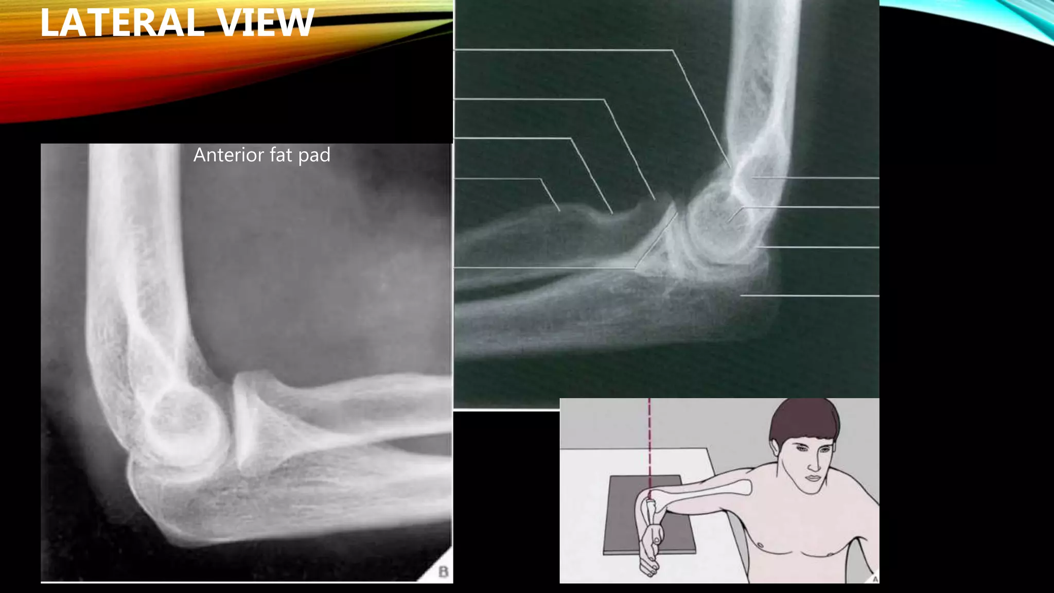 Normal X ray of long bones.pptx
