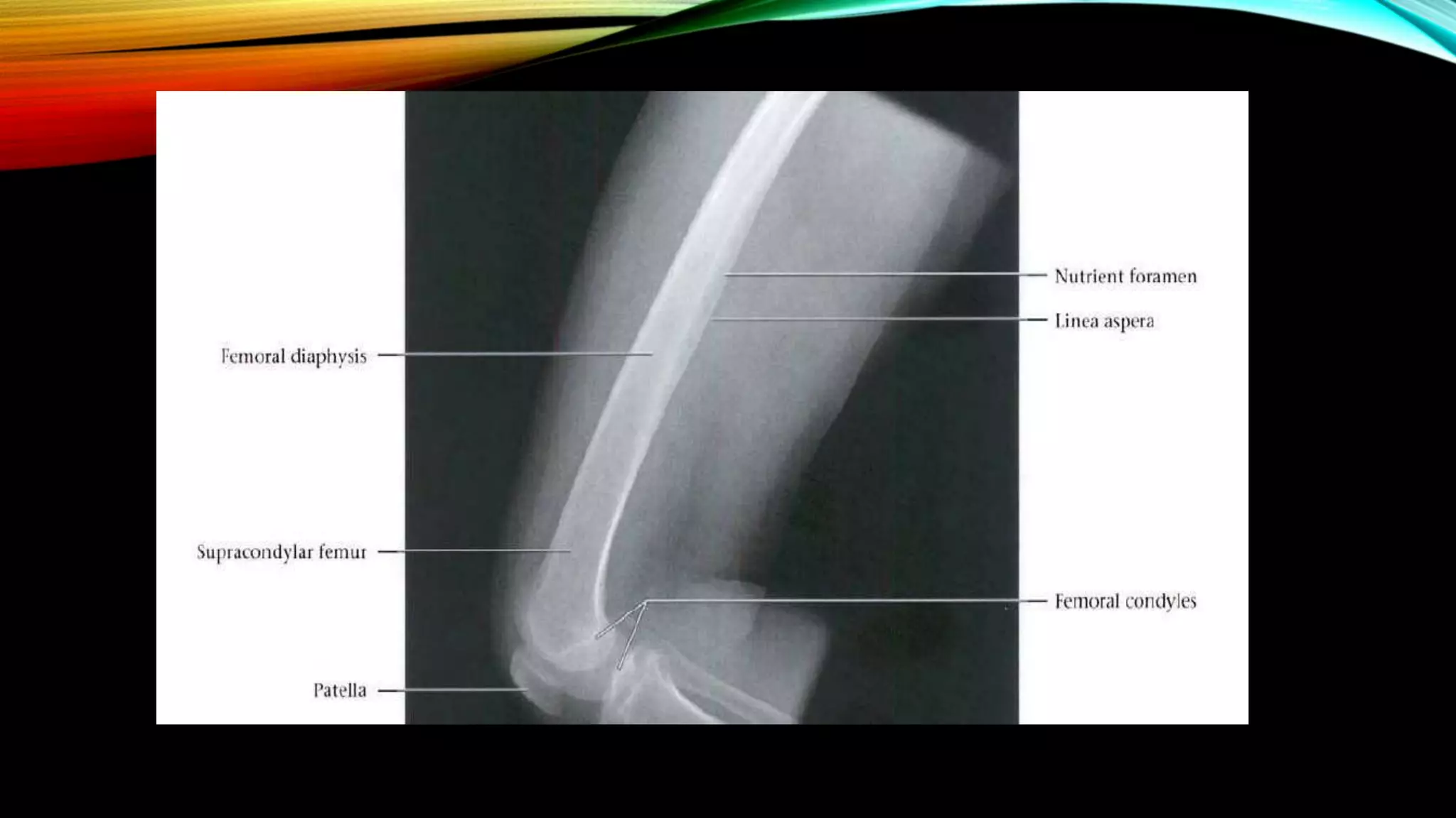 Normal X ray of long bones.pptx