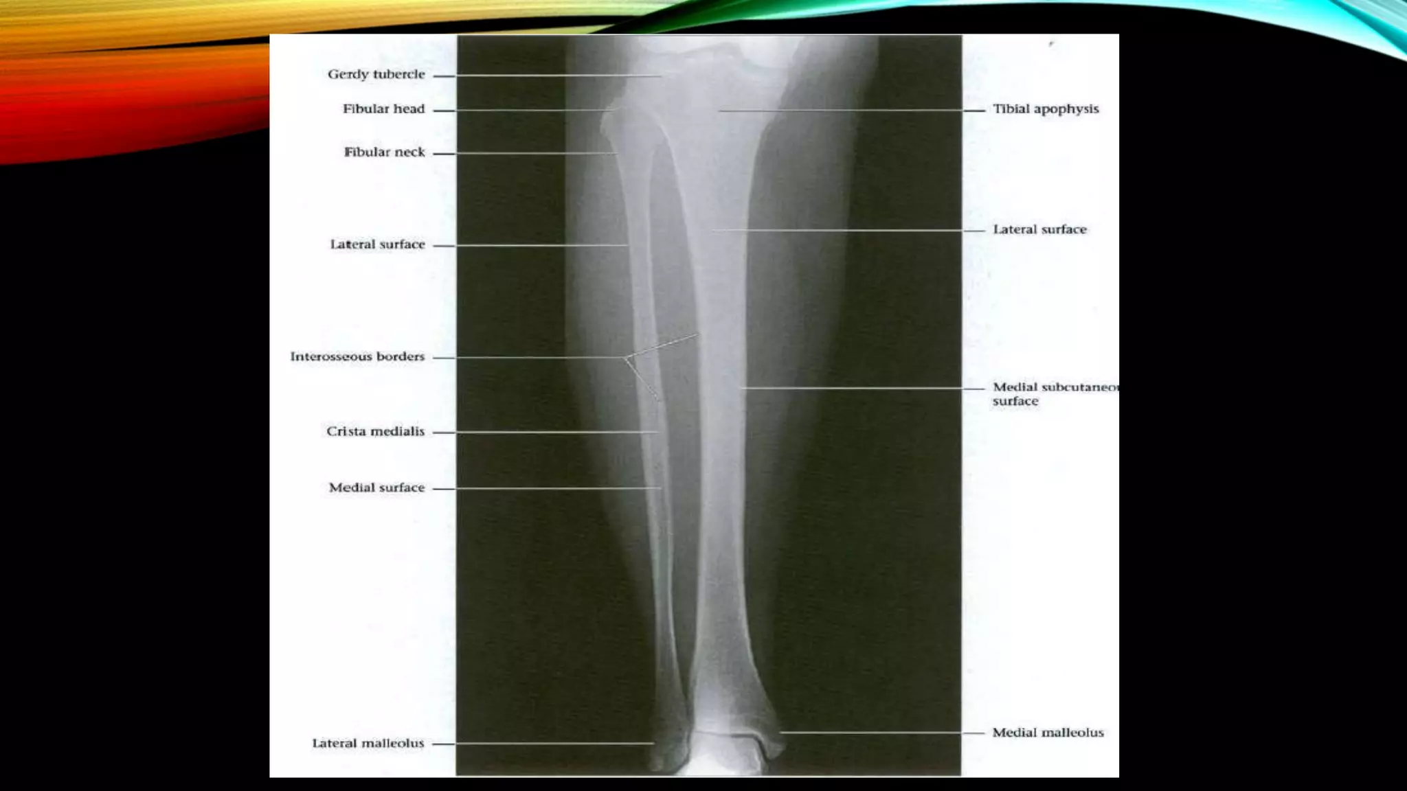 Normal X ray of long bones.pptx