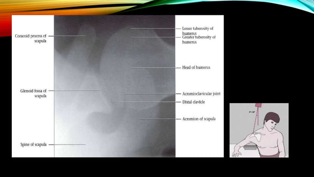 Normal X ray of long bones.pptx