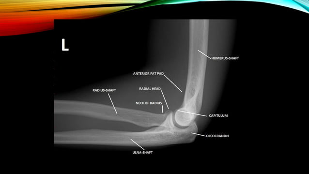 Normal X ray of long bones.pptx