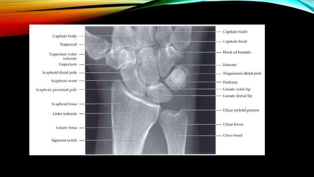 Normal X ray of long bones.pptx