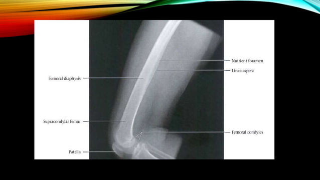 Normal X ray of long bones.pptx