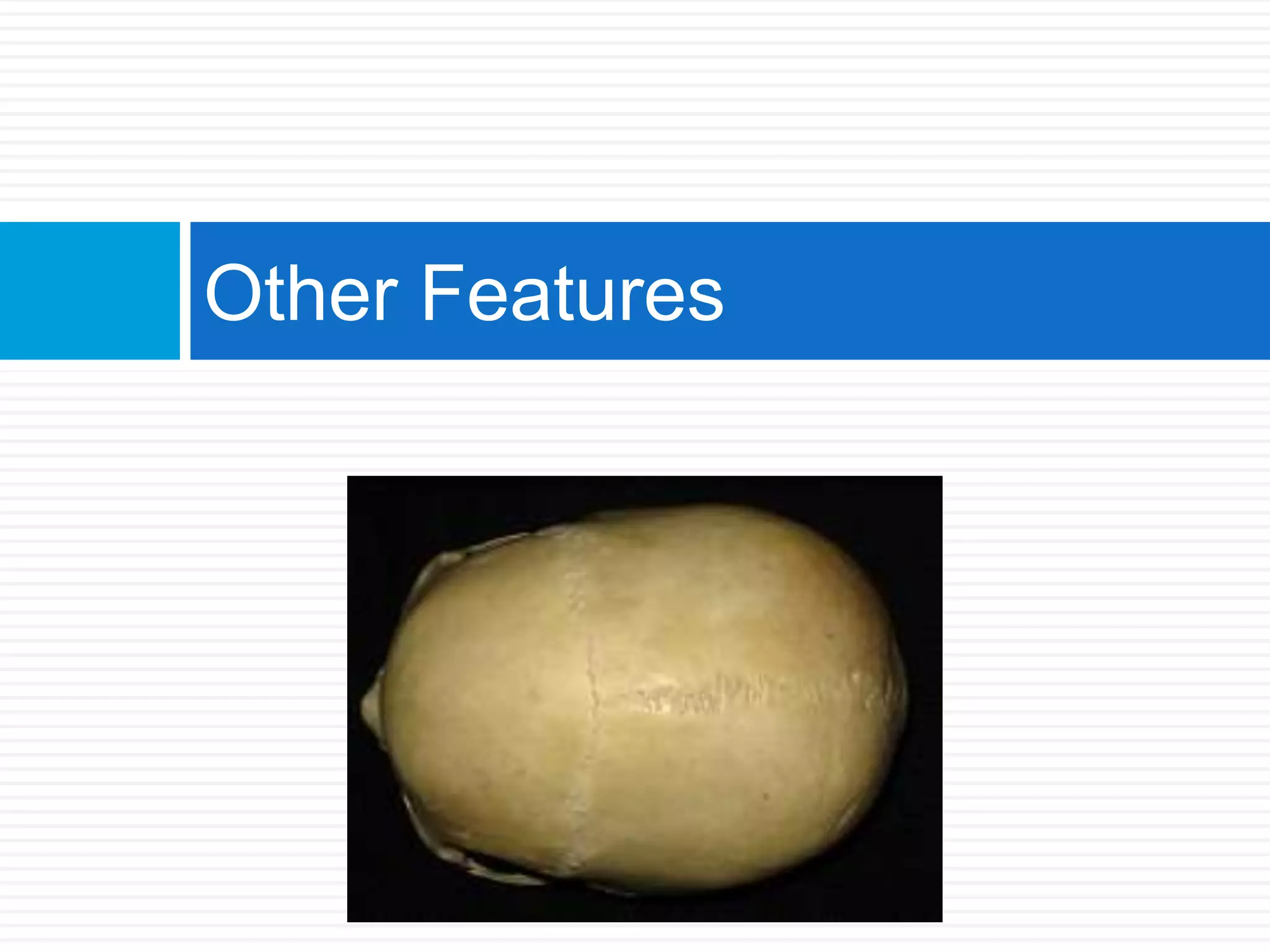 Norma Verticalis | PPTX