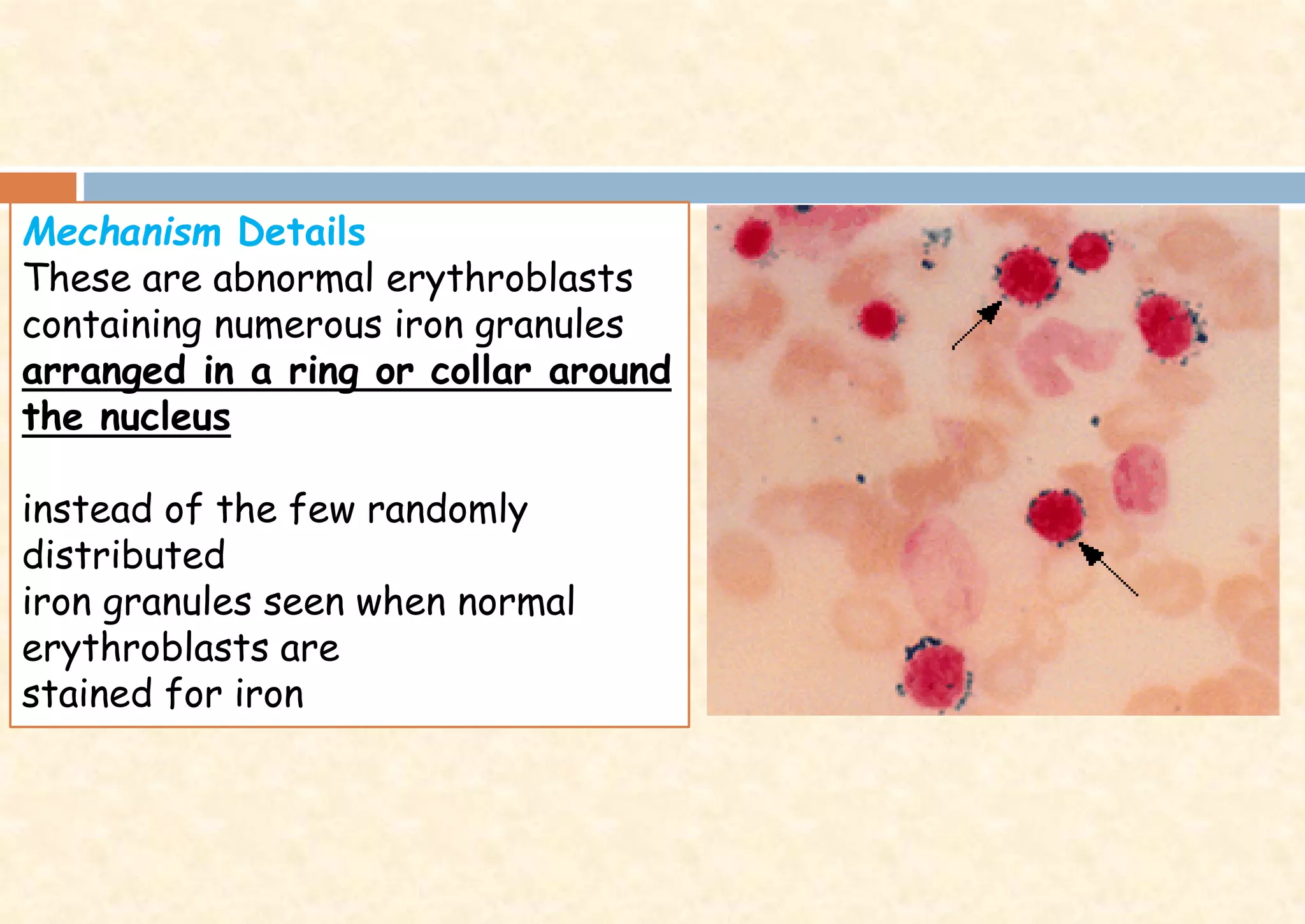 Normocytic Anemias.pdf | Blood Disorders | Diseases and Conditions