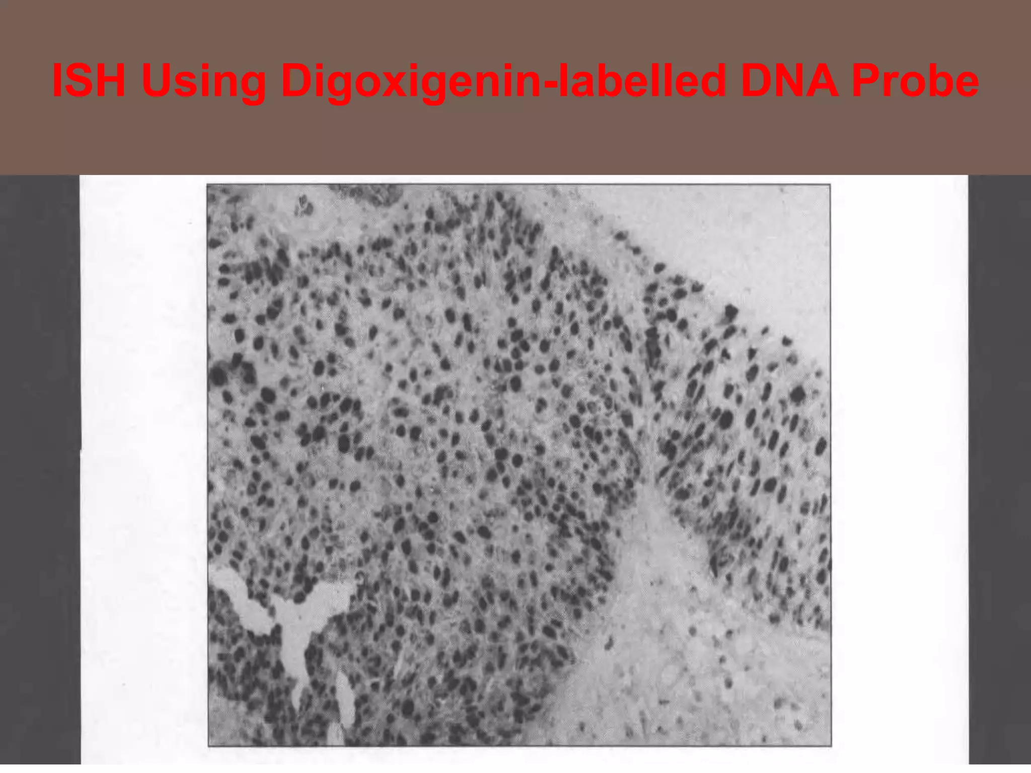 Northern, southern and western blotting | PPTX