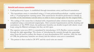 Norwood Procedure.pptx