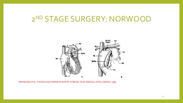 HYPOPLASTIC LEFT HEART SYNDROME & NORWOOD PROCEDURE- A REVIEW