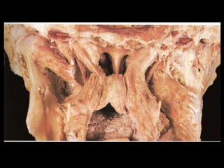 Nose-1 (Muhadharaty). | PPT