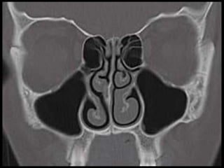 Nose-1 (Muhadharaty). | PPT