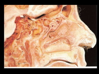 Nose-1 (Muhadharaty). | PPT