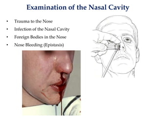 anatomy and physiology of Nose and its disorders | PPTX