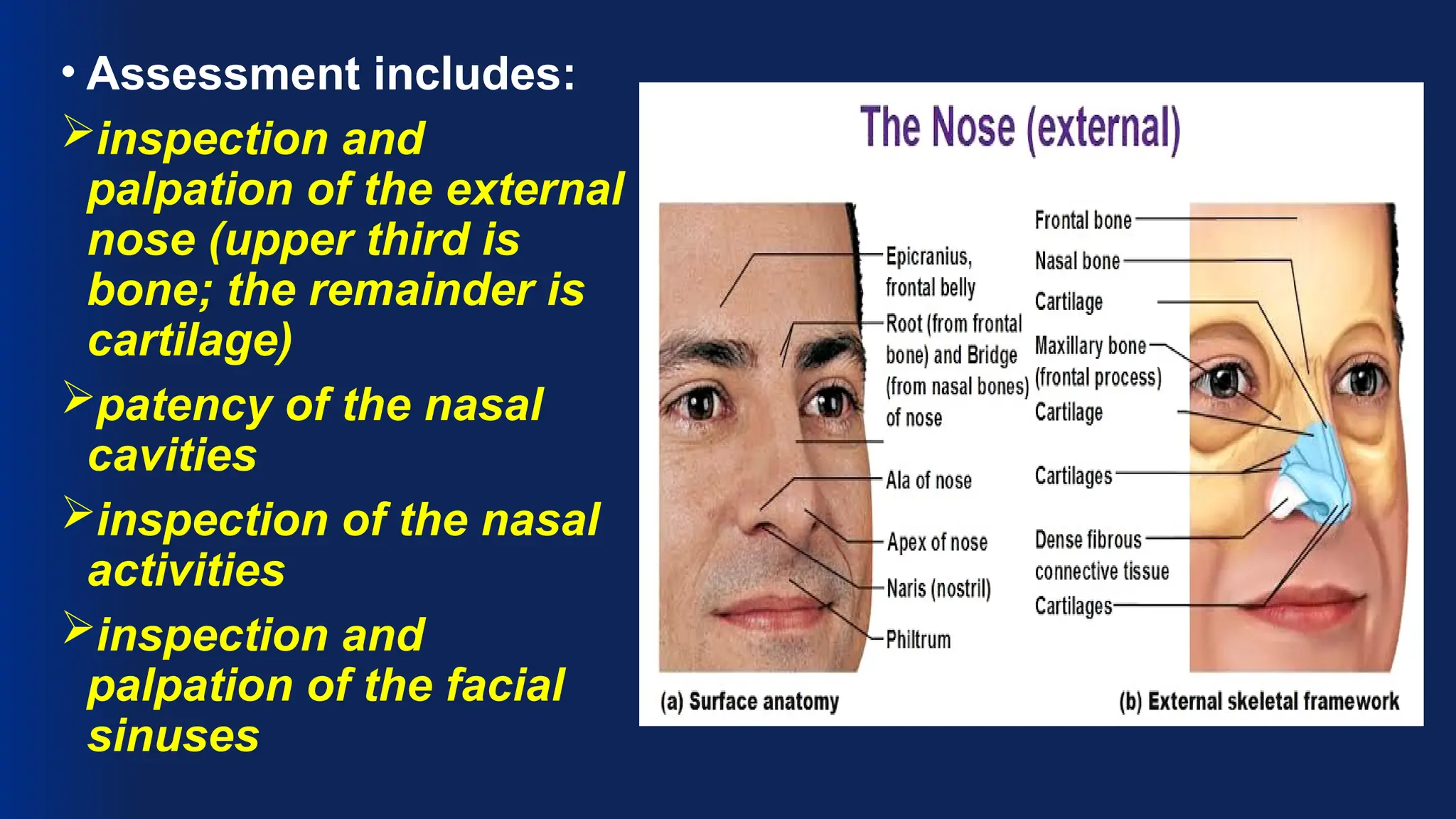 NOSE-AND-SINUSE-1ahqt4hc46h365h45h54ch54hc6 | PPTX