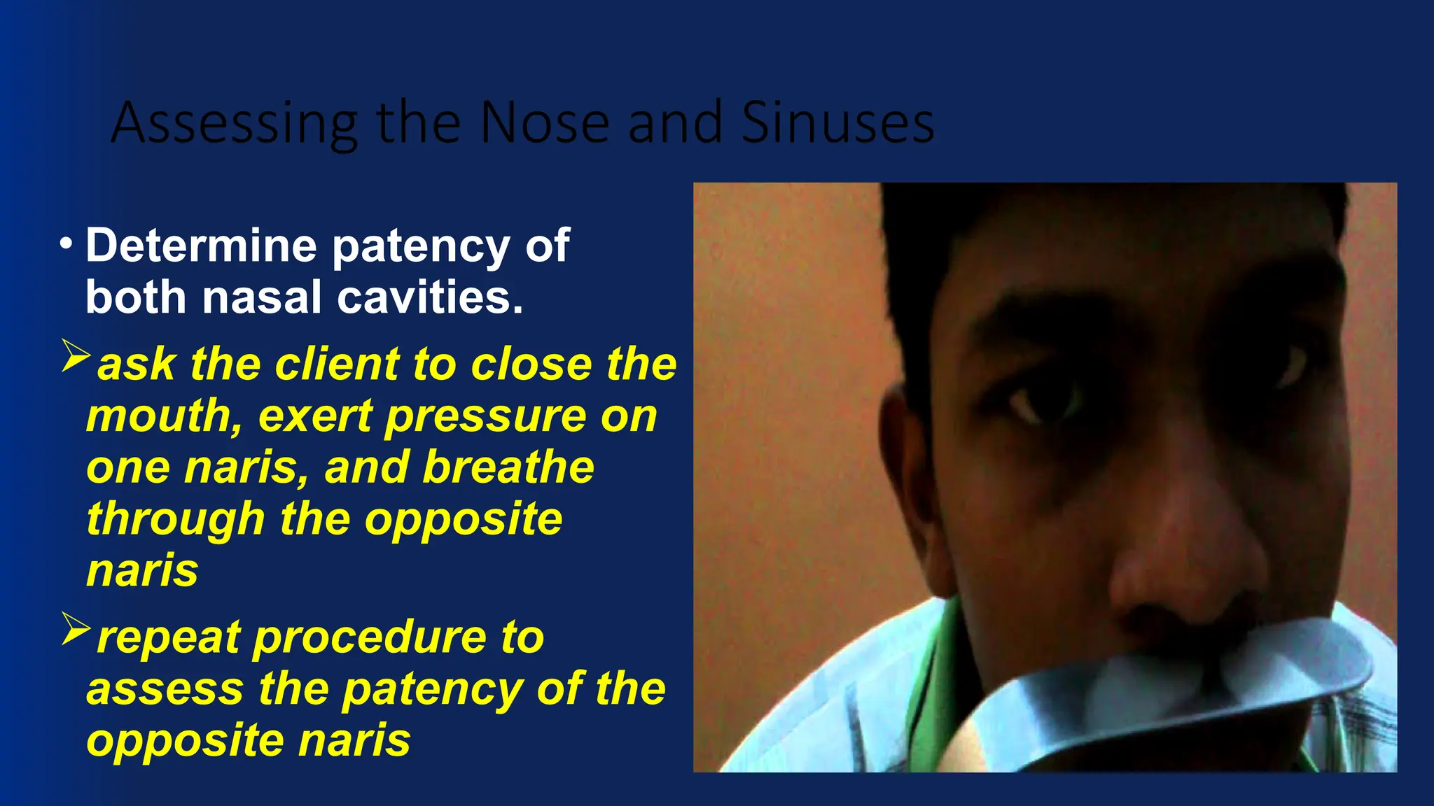 NOSE-AND-SINUSE-1ahqt4hc46h365h45h54ch54hc6 | PPTX