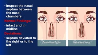 NOSE-AND-SINUSE-1ahqt4hc46h365h45h54ch54hc6 | PPT