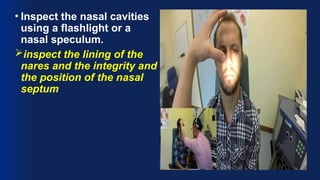 NOSE-AND-SINUSE-1ahqt4hc46h365h45h54ch54hc6 | PPT
