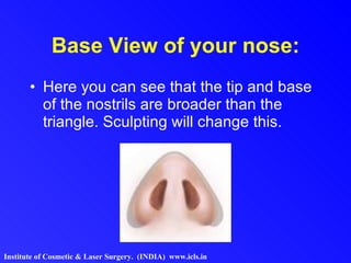 Nose Job. Rhinoplasty | PPT
