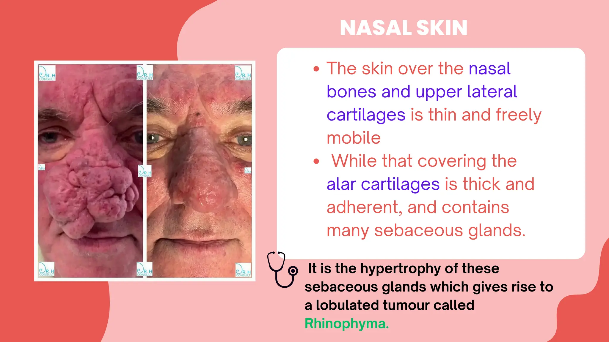 NOSE ANATOMY with complete description.pdf