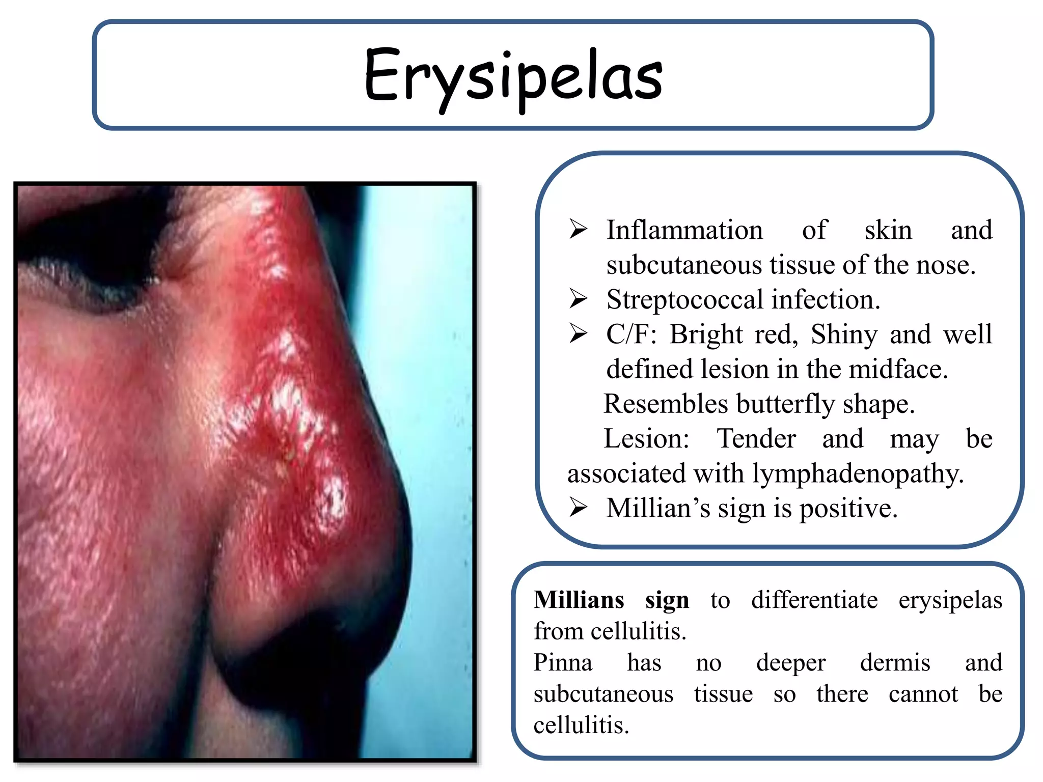 Nose anatomy and physiology | PPTX