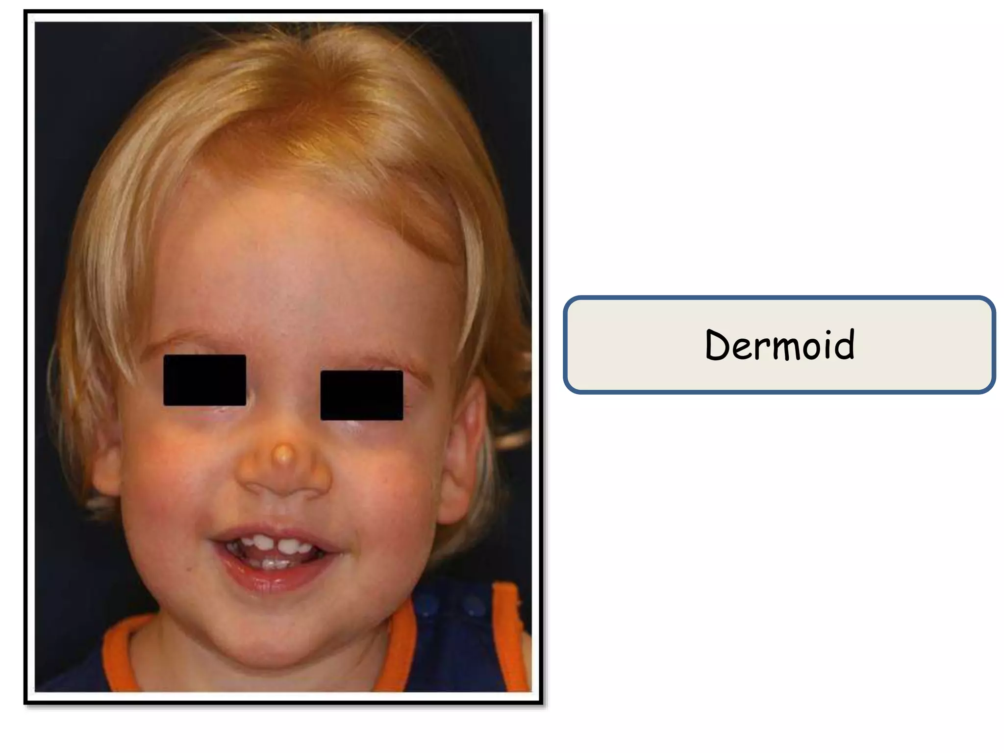 Nose anatomy and physiology | PPTX