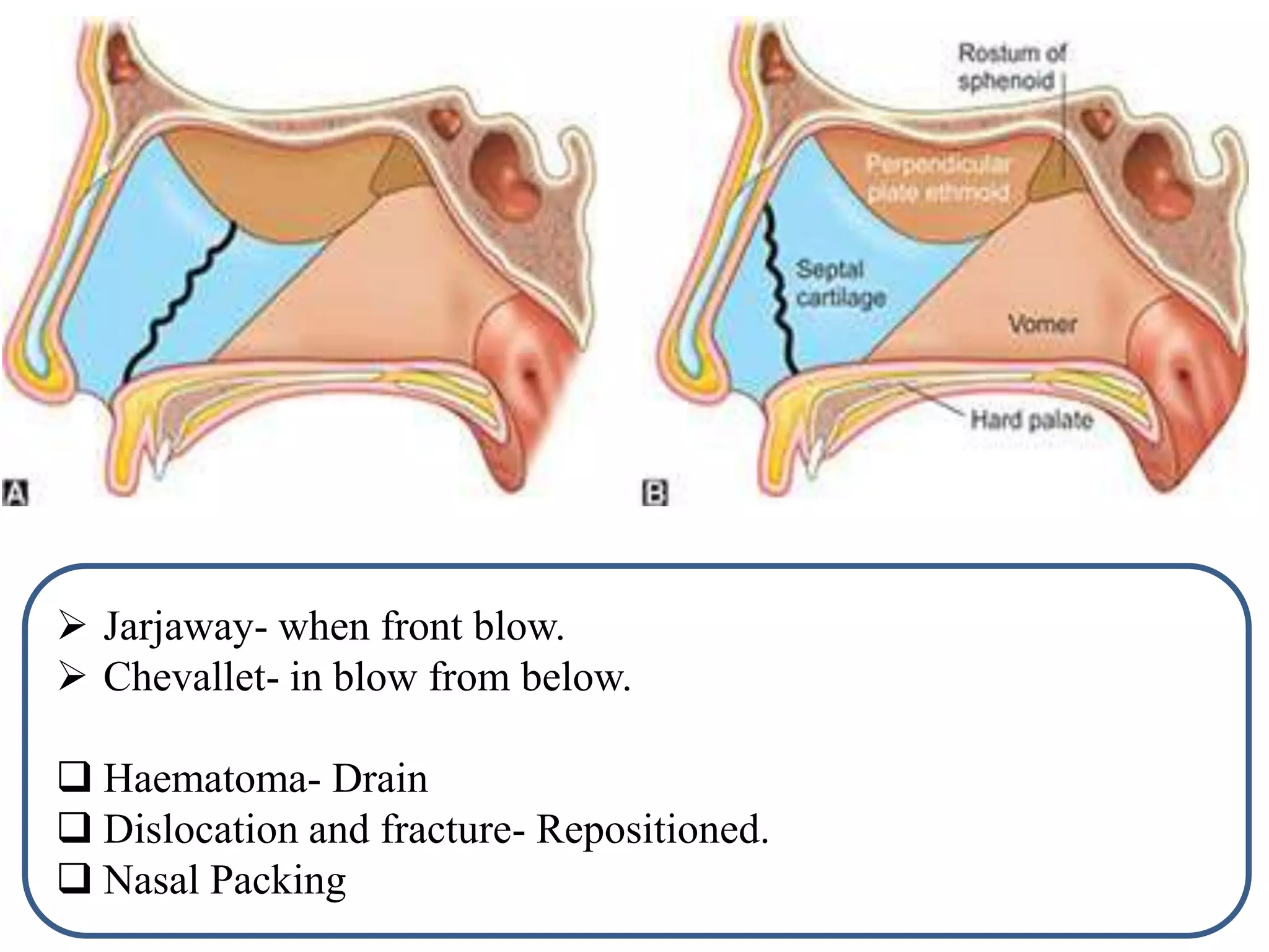 Nose anatomy and physiology | PPTX