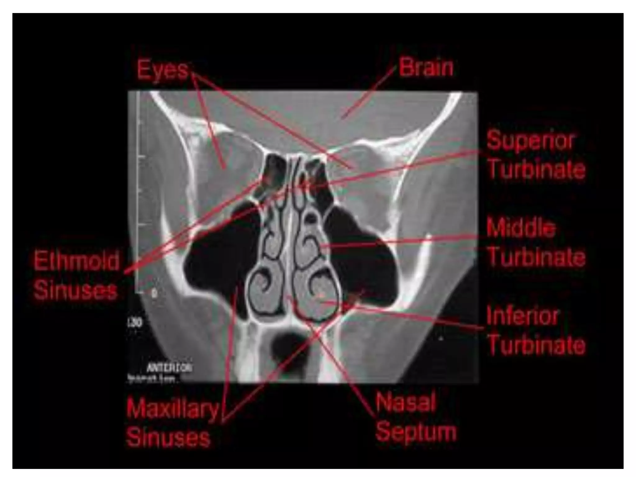 Nose anatomy and physiology | PPTX