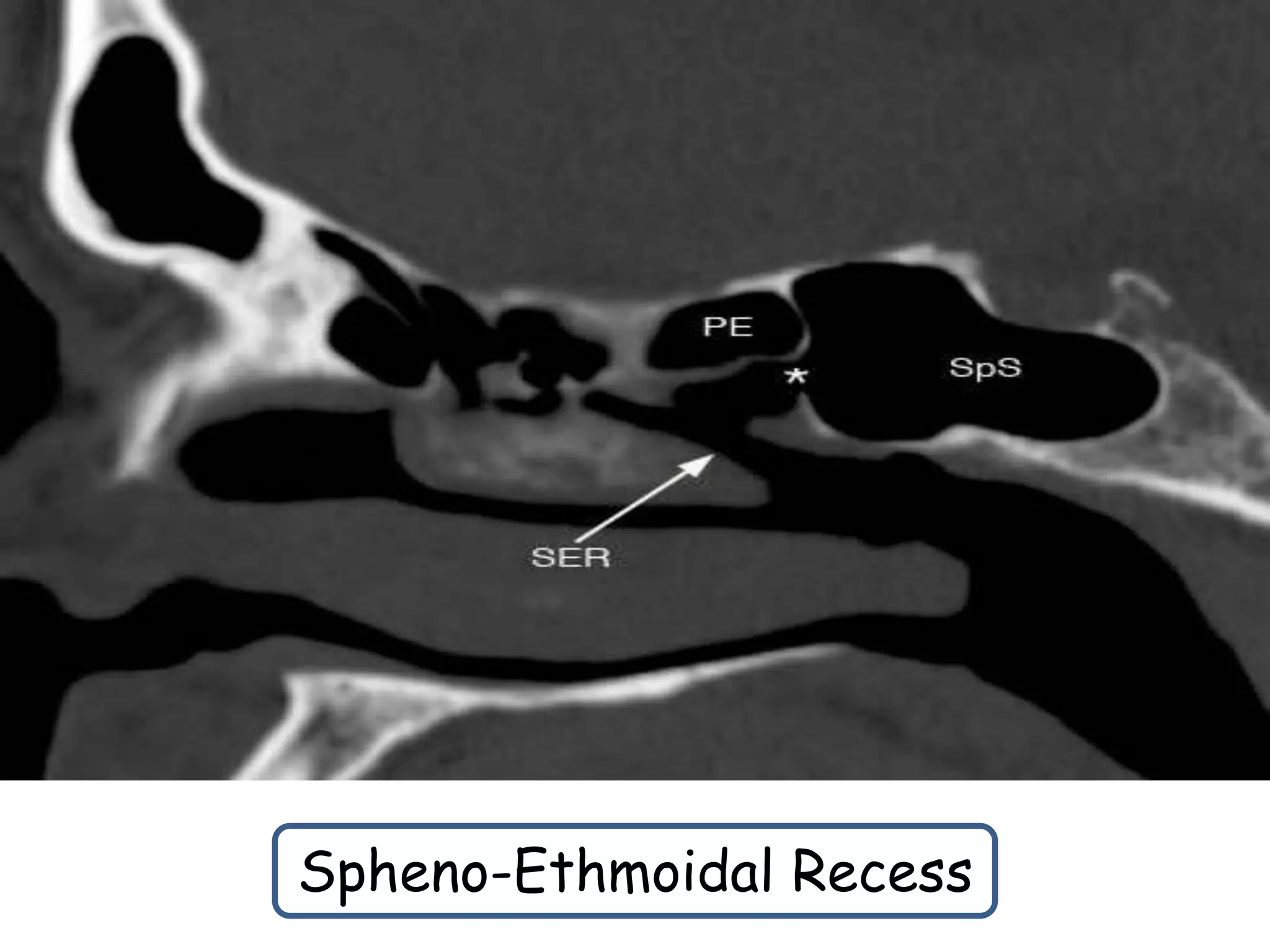 Nose anatomy and physiology | PPTX