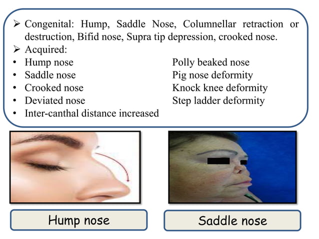 Nose anatomy and physiology | PPTX