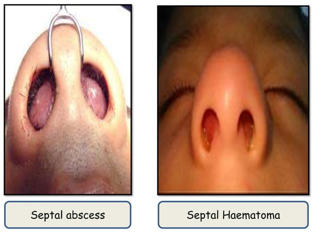 Nose anatomy and physiology | PPTX