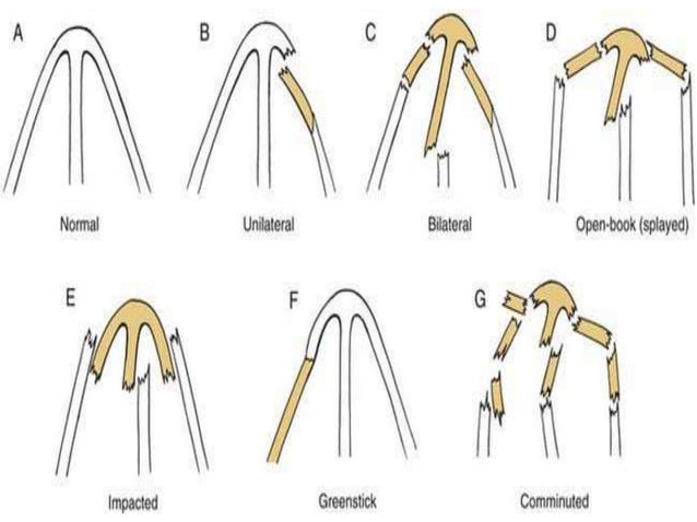 Nose anatomy and physiology | PPTX