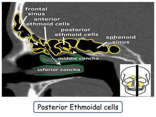 Nose anatomy and physiology | PPTX