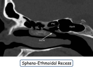 Nose anatomy and physiology | PPTX